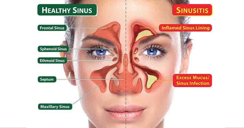 Why Mucus Is Good For You