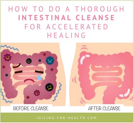 Gastrointestinal Cleanse And Detox - How To Supercharge Your Healing